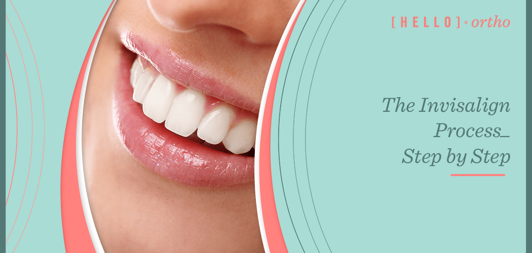 The Invisalign Treatment Journey A Step By Step Process Hello Ortho